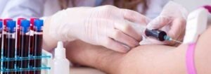 How Long Do Blood Test Results Take in Manchester? - Everest Pharmacy