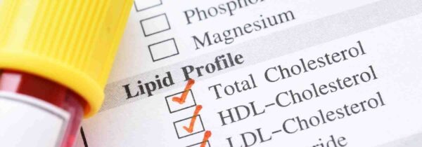 Is a Cholesterol of 5.7 High? What Your Blood Test Really Means ...